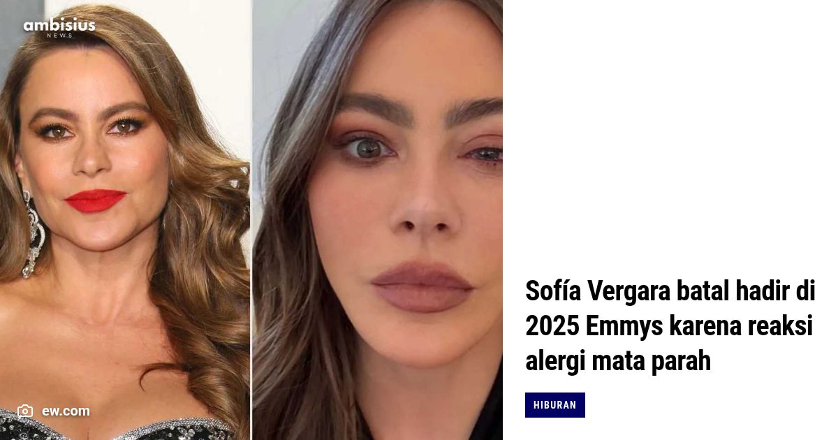 Sofía Vergara batal hadir di 2025 Emmys karena reaksi alergi mata parah
